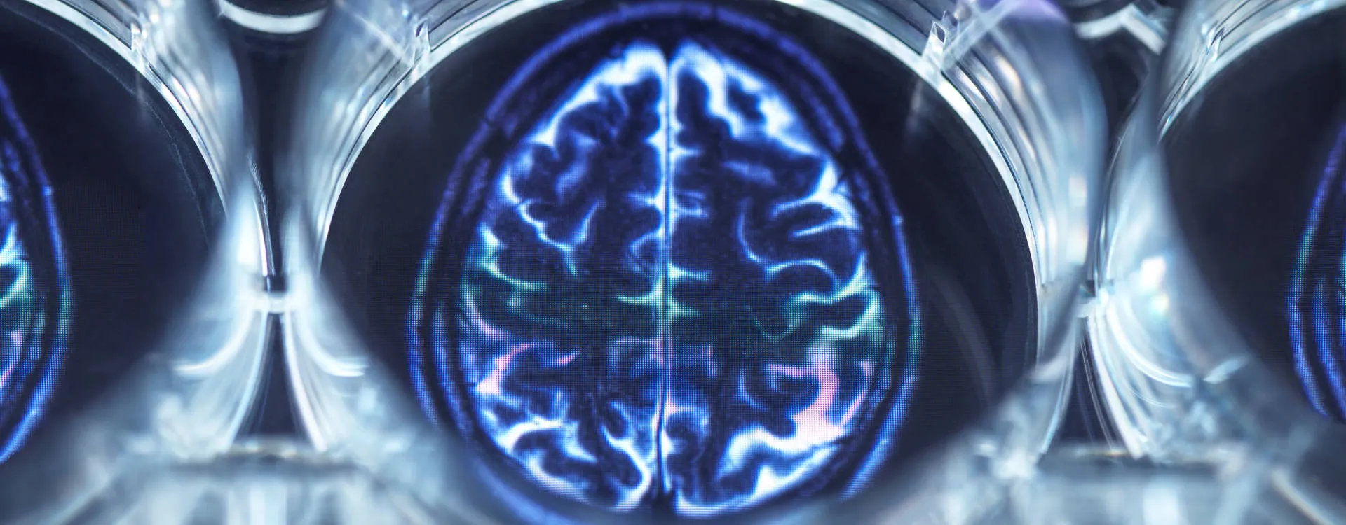 Neuroimaging tests